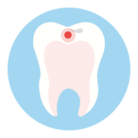 Types of Cavities & How to Prevent Them | Gentle Dental Blog 🦷