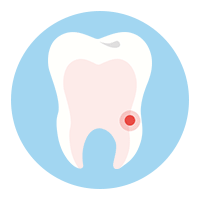 Types of Cavities & How to Prevent Them | Gentle Dental Blog 🦷