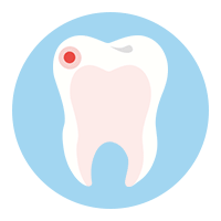 Types of Cavities & How to Prevent Them | Gentle Dental Blog 🦷